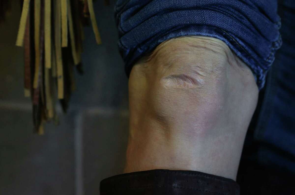 For bullfighters and rodeo riders, a life of scars and stories