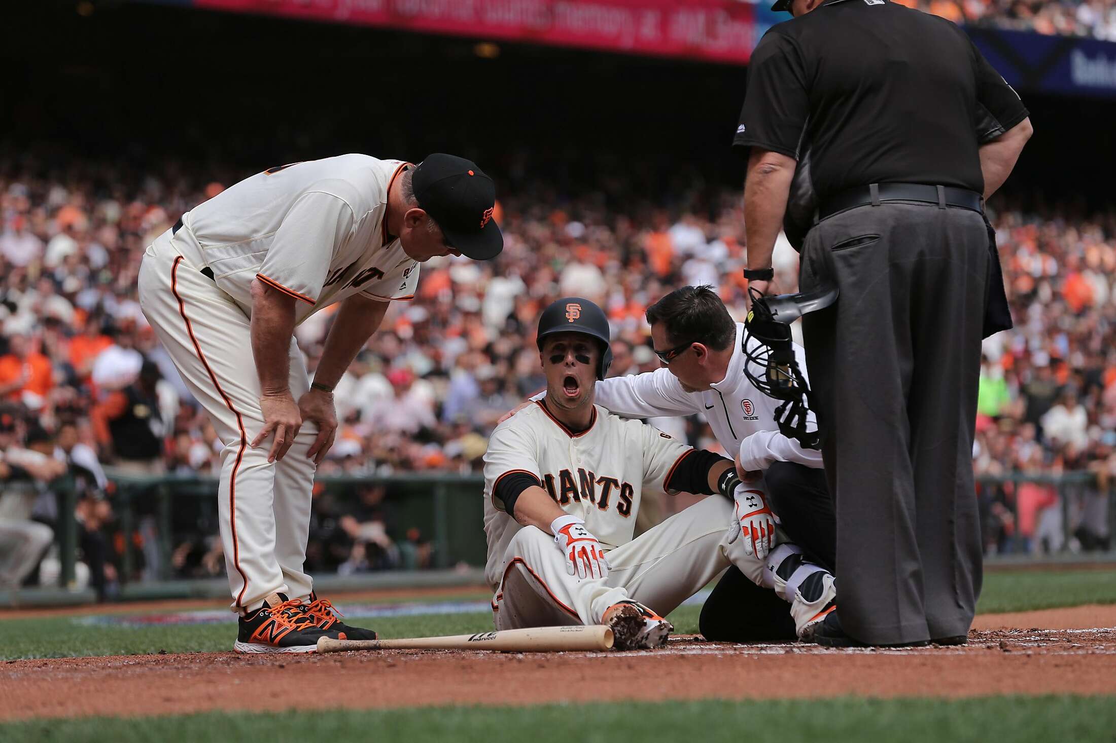Posey’s beaning casts pall over Giants’ home opener
