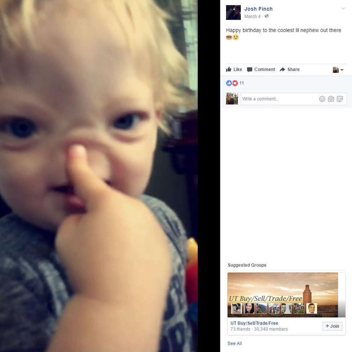 Baby boy born without a nose dies at 2 years old