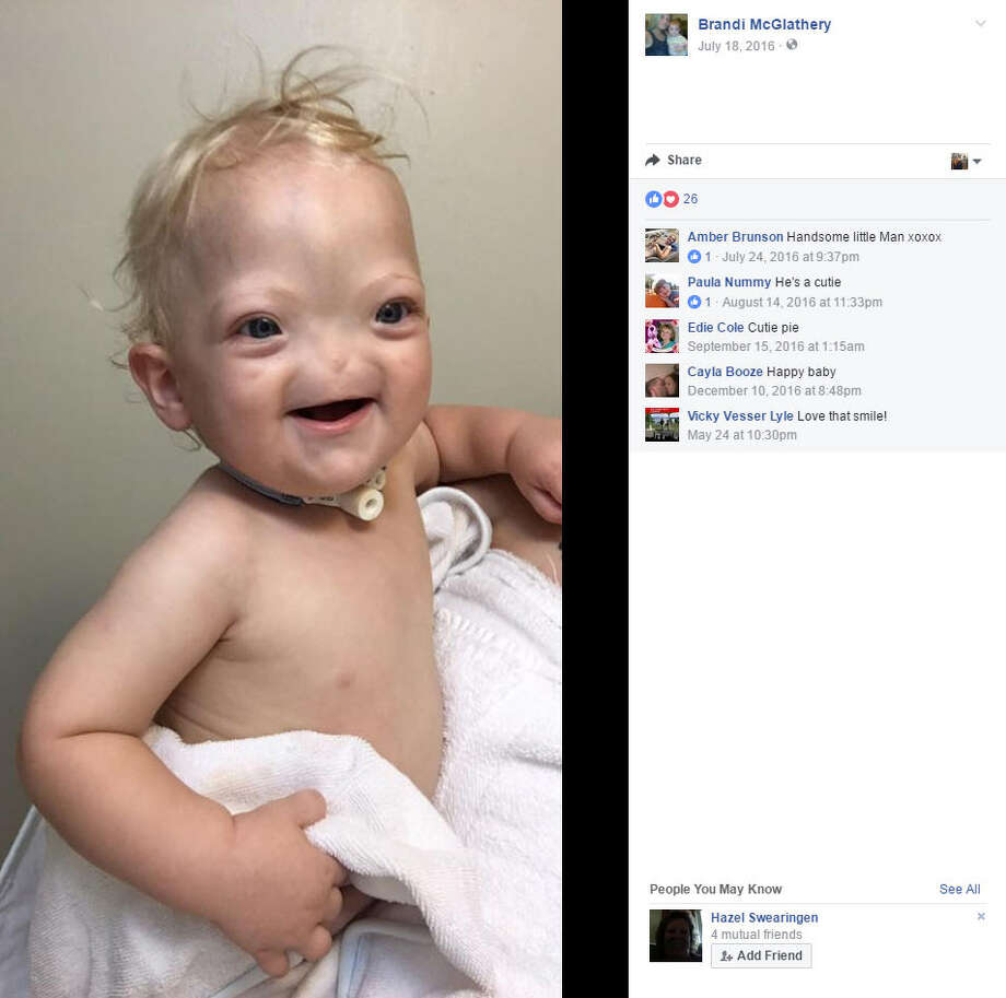 Baby boy born without a nose dies at 2 years old - Houston Chronicle