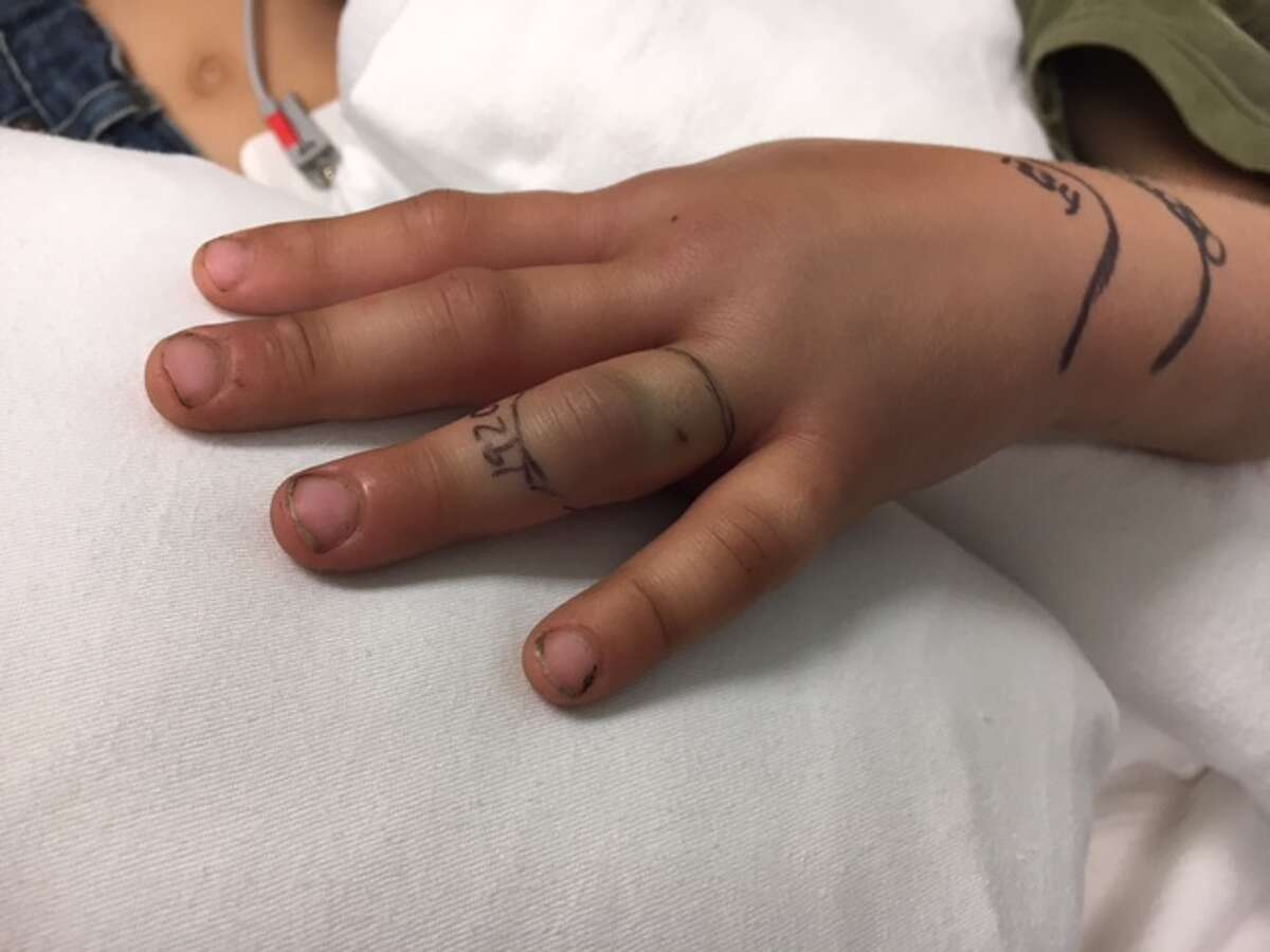 Copperhead snakes take multiple bites out of North Texas man