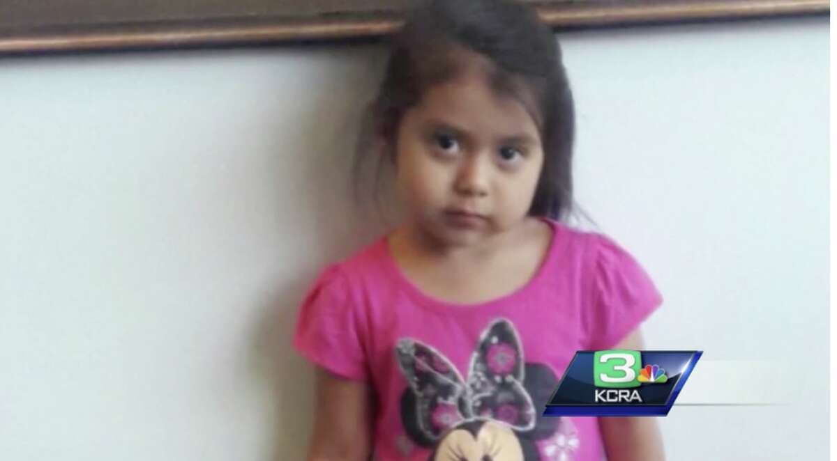 Stockton toddler dies after routine dental procedure
