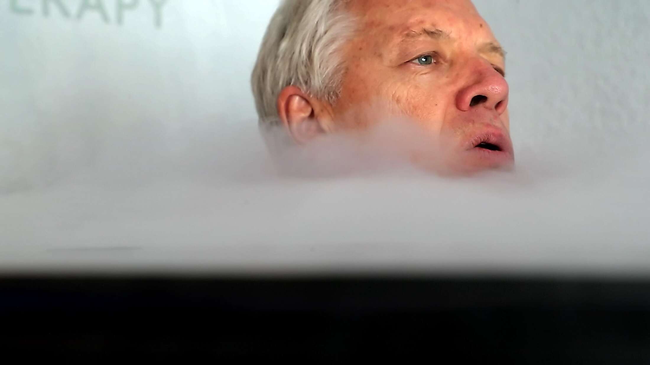 Cryotherapy: Is it the coolest thing in sports medicine?