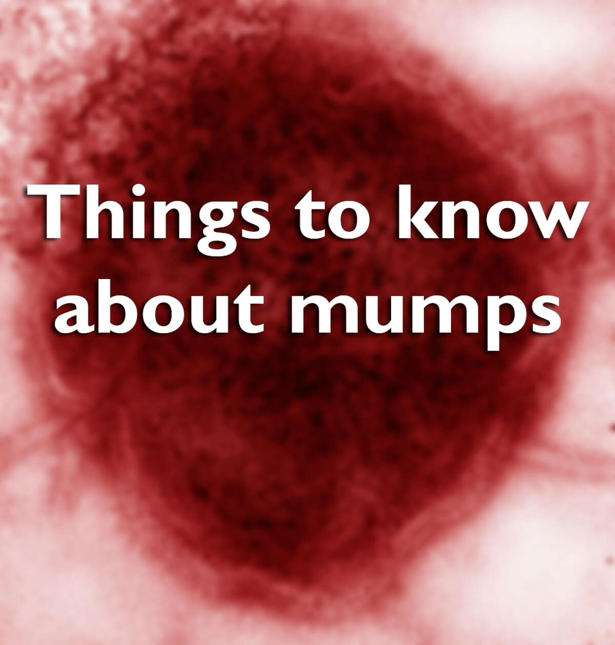 Mumps outbreak confirmed at ICE detention facility in Houston