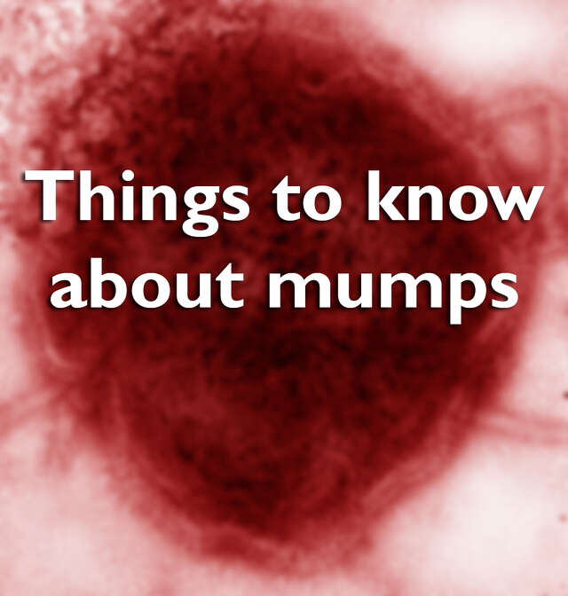 Mumps outbreak confirmed at ICE detention facility in Houston