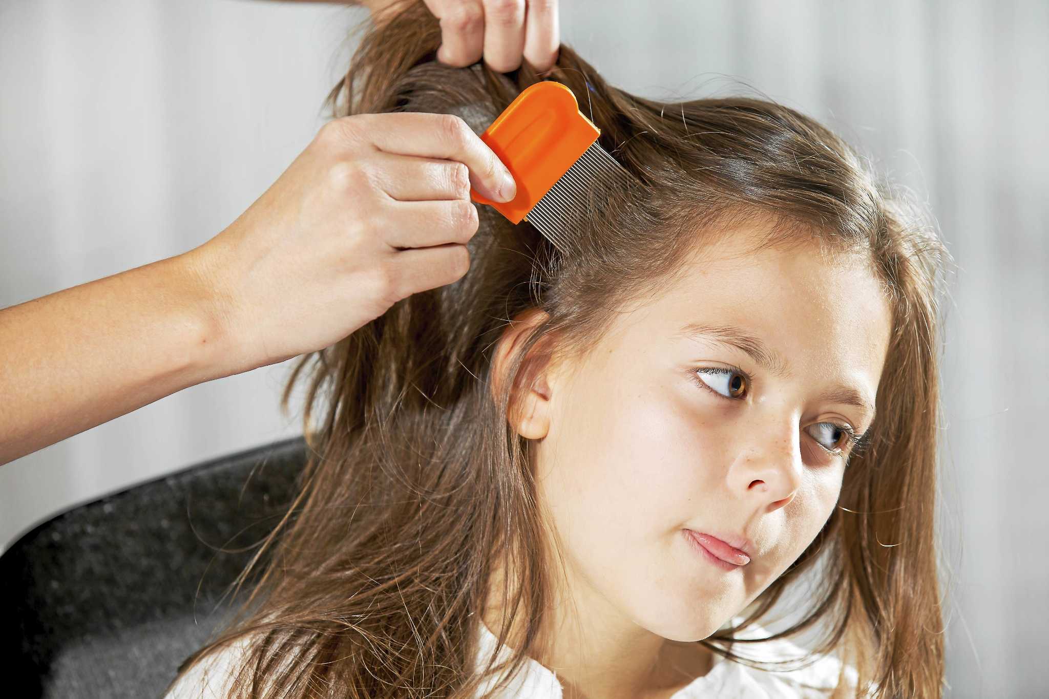 Connecticut ‘super lice’ resistant to some treatments, study finds