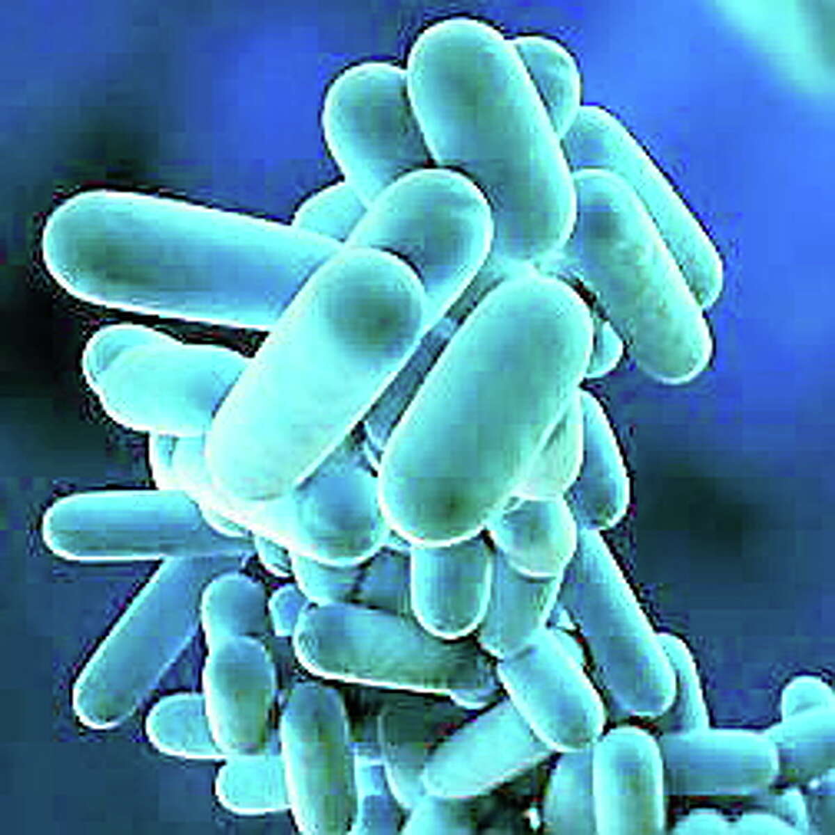 Legionella bacteria found in water at West Haven VA hospital
