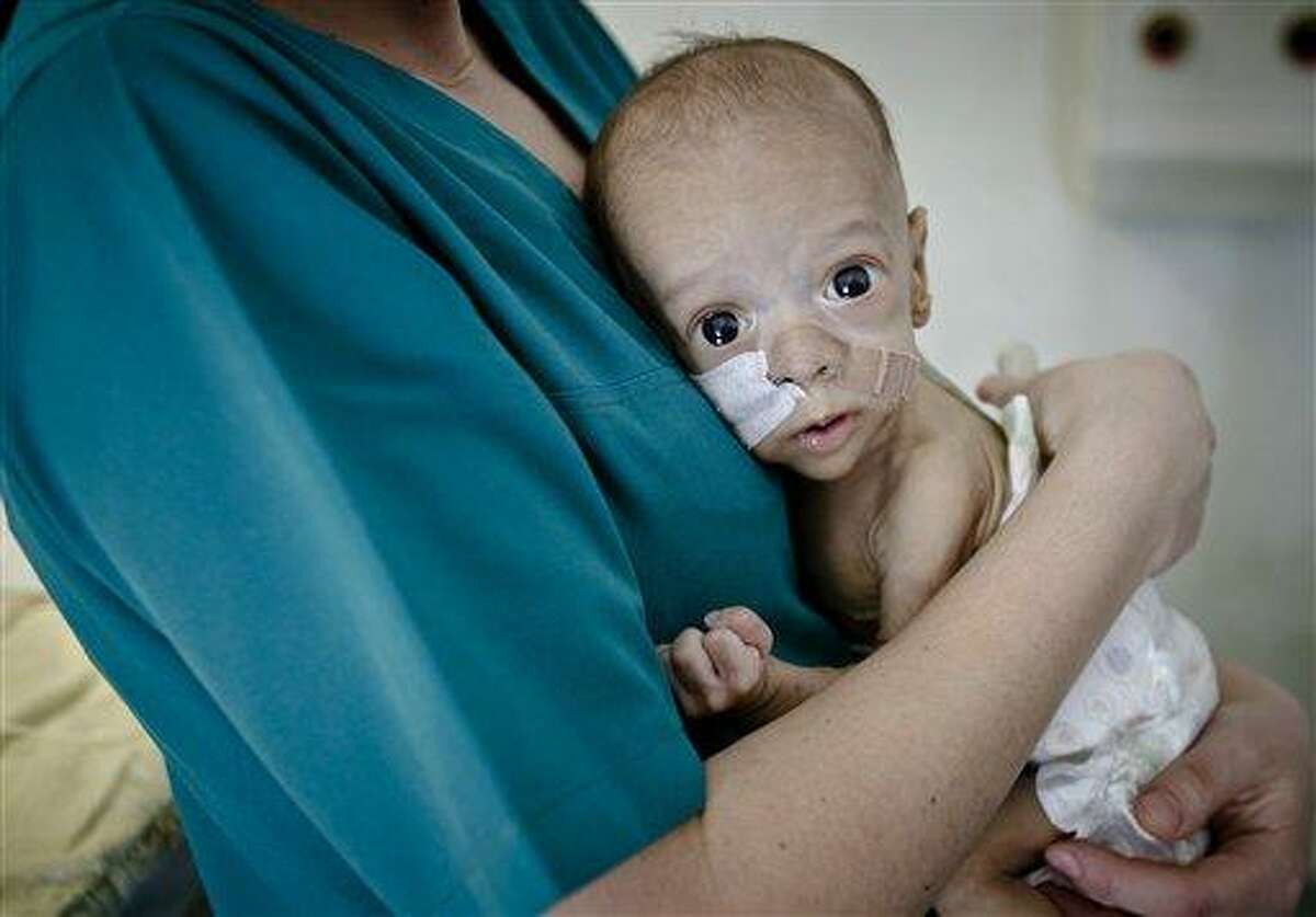 Romanian baby born with almost no intestines gets lifesaving surgery ...