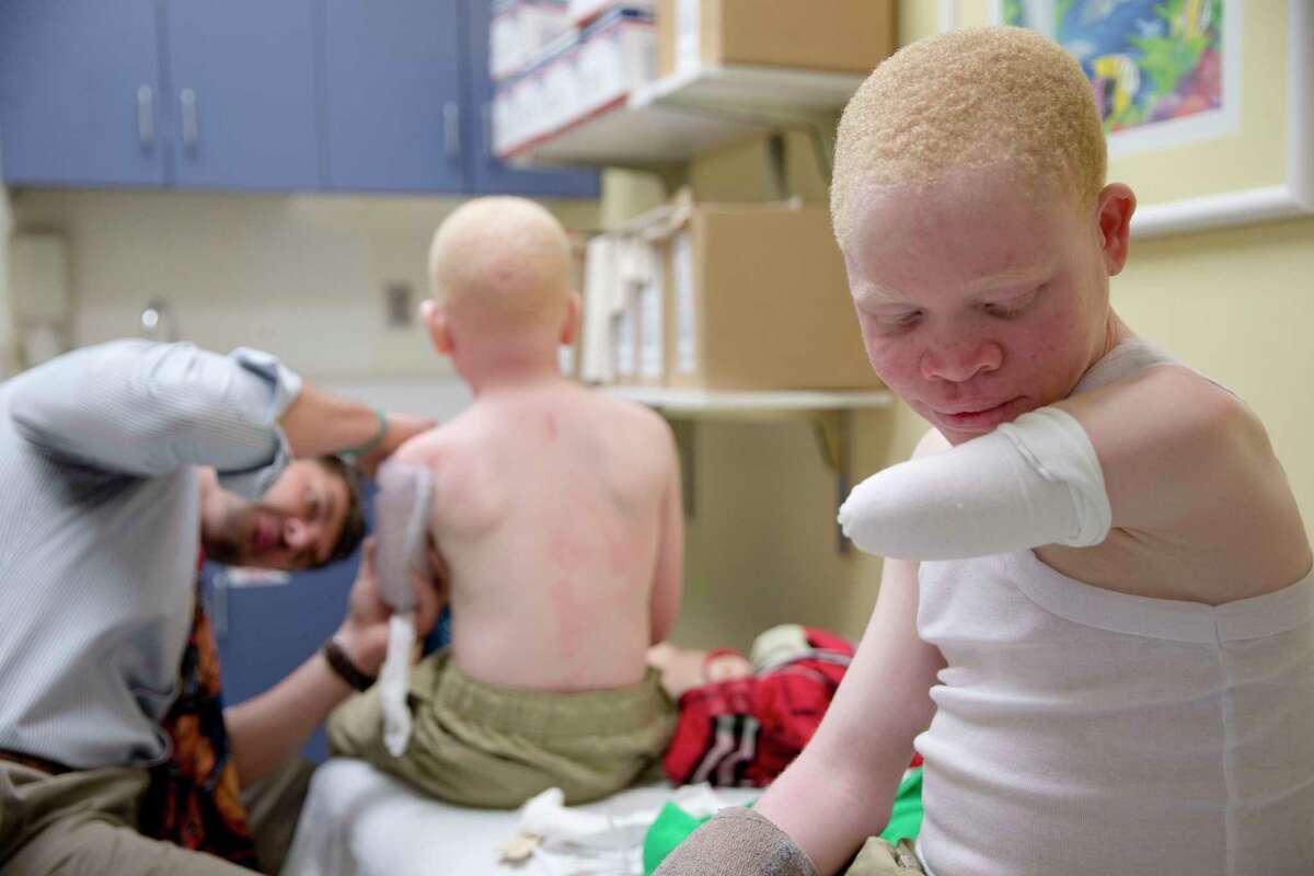 Photos of albino children hunted, maimed for their body parts