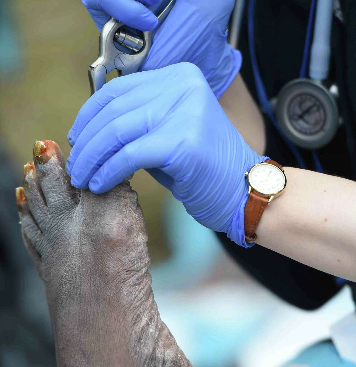 160324ph_Homeless Foot Washing