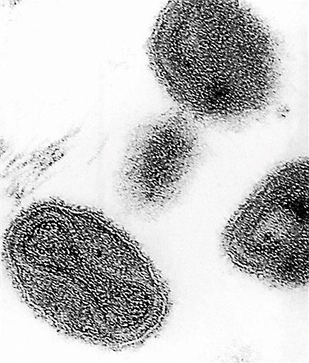 Vials of decades-old smallpox found at National Institutes of Health