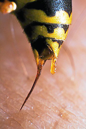 Yale study finds bee sting venom may bring immunity against the pain