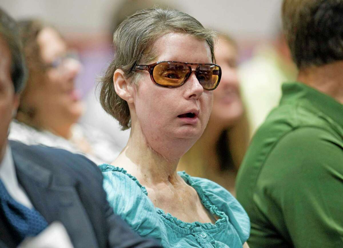 Bill pushed by Connecticut chimp attack victim clears panel