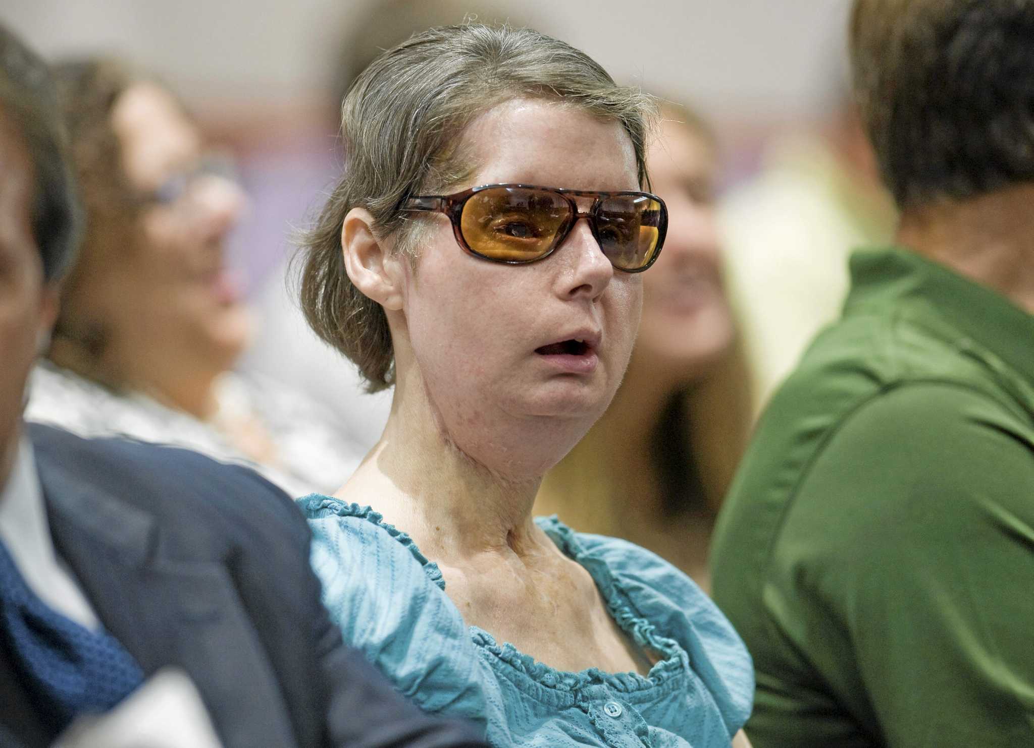 Bill pushed by Connecticut chimp attack victim clears panel