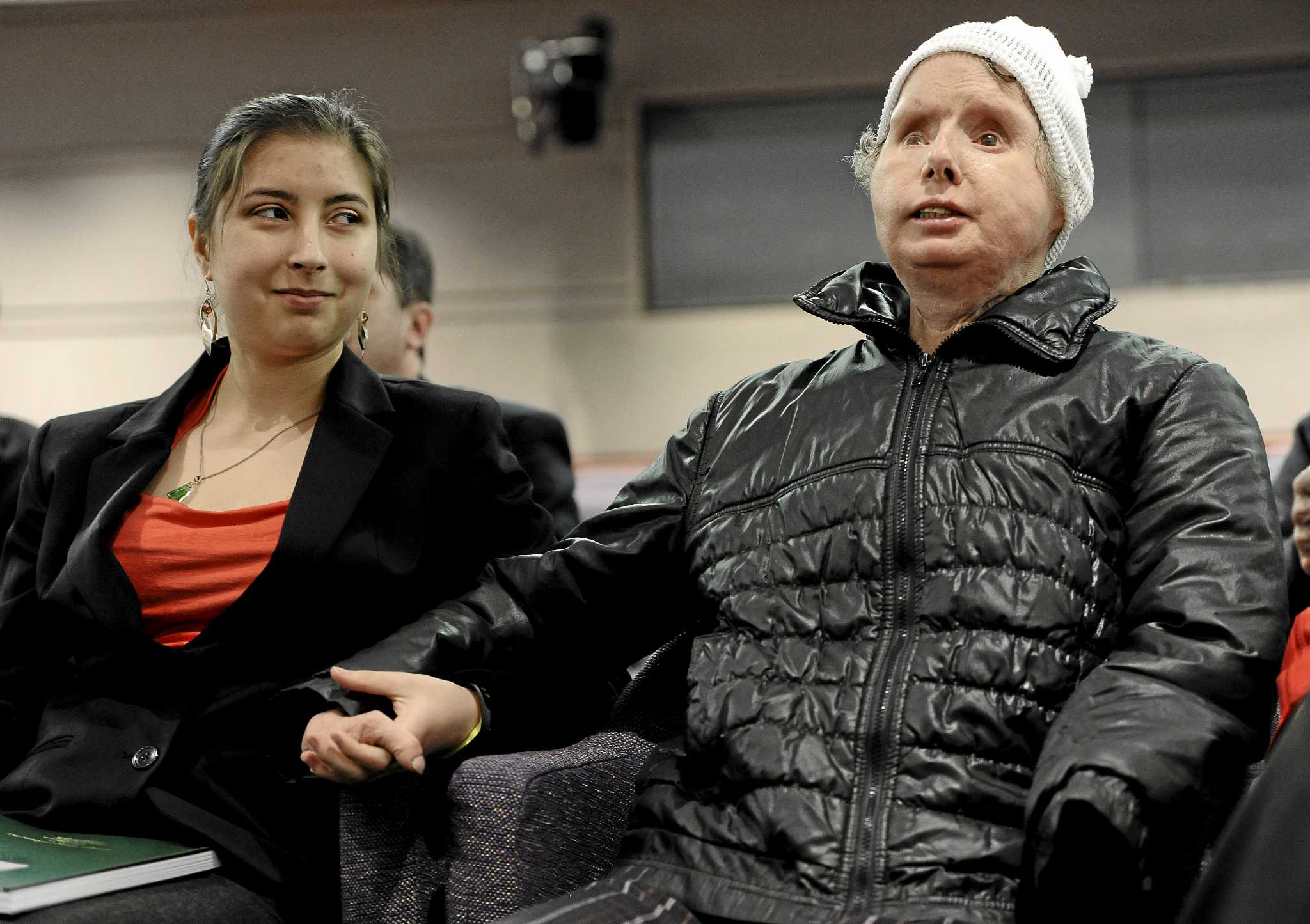 Charla Nash Attack Scene