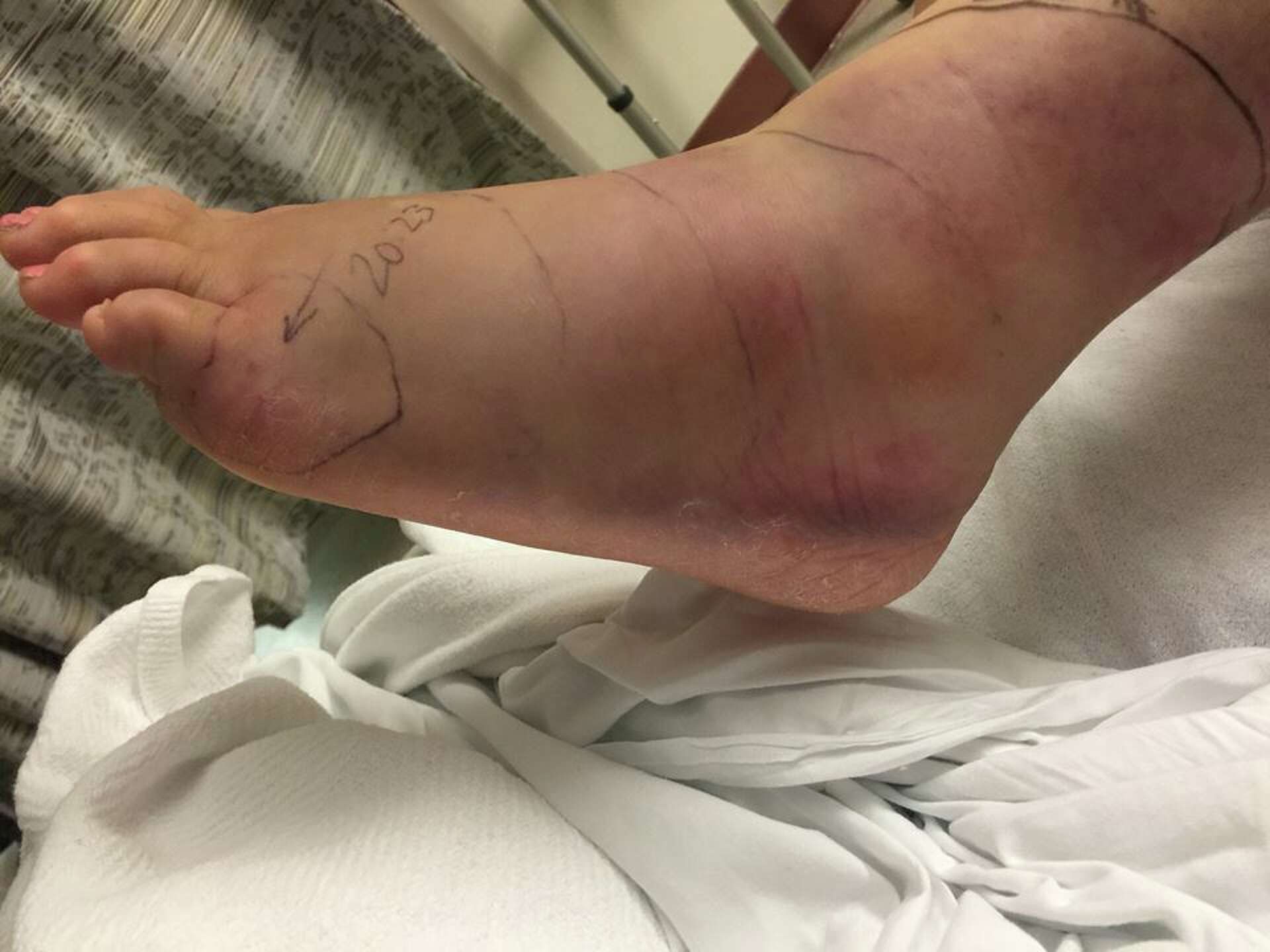 Virginia woman bitten by copperhead snake inside a LongHorn Steakhouse
