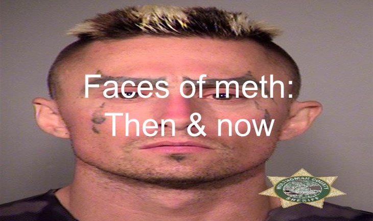 Faces of meth: Then & now