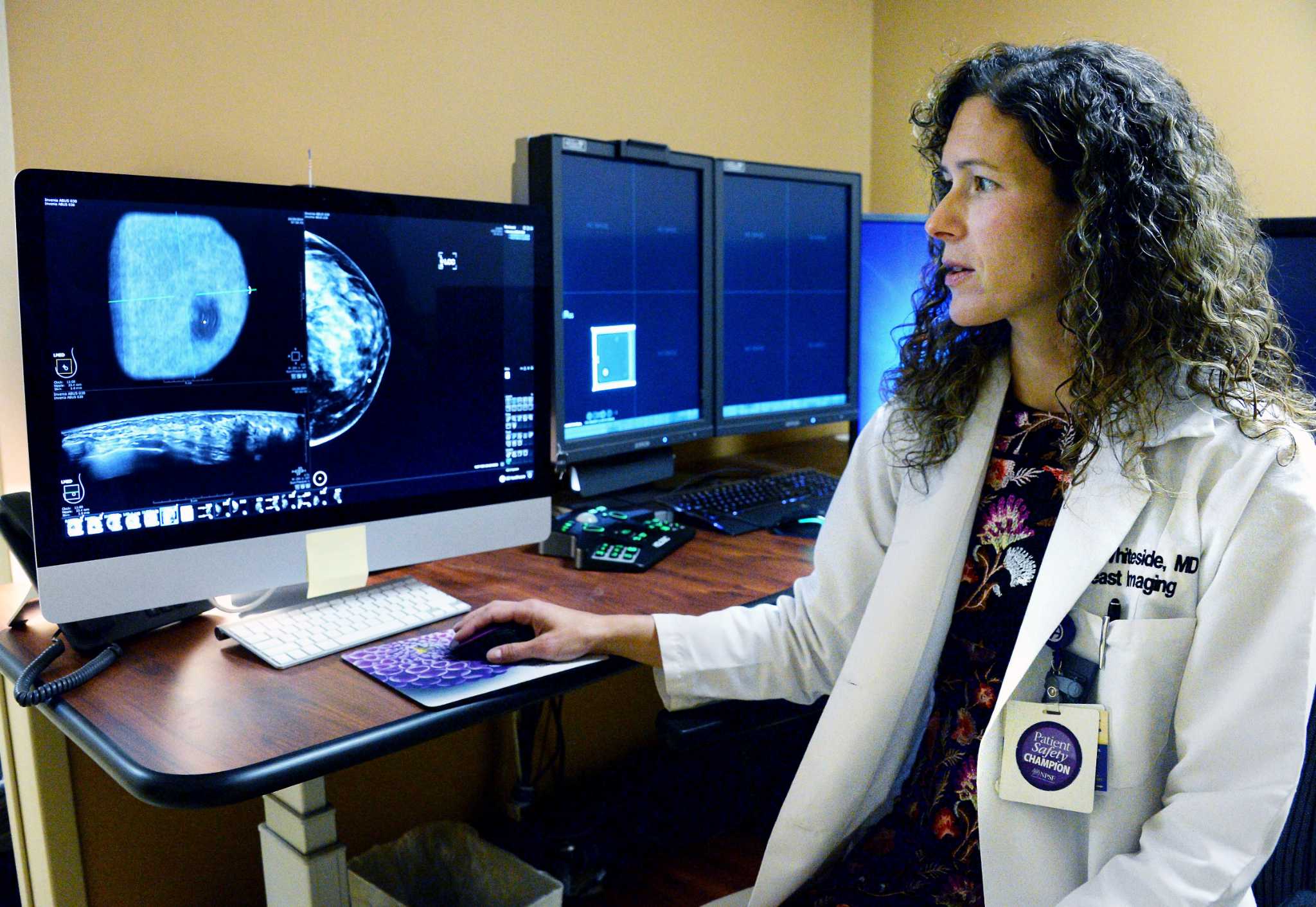 New breast cancer screening tools make their way to Capital Region ...