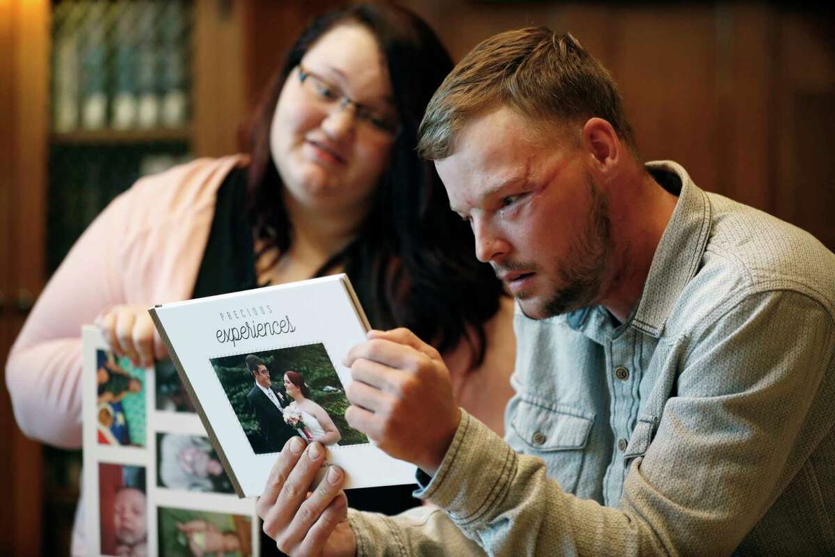Emotional meeting brings together face transplant recipient, donor's family