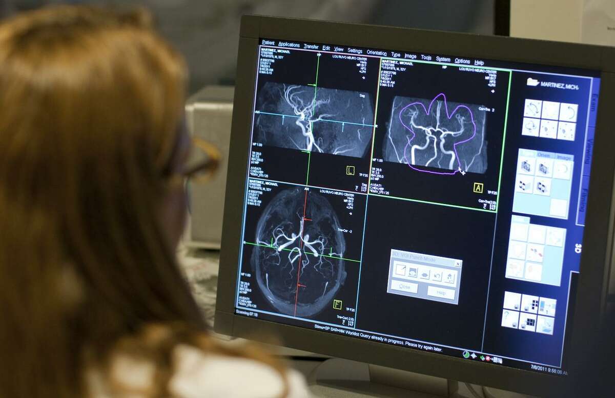 First blood test to detect concussions approved