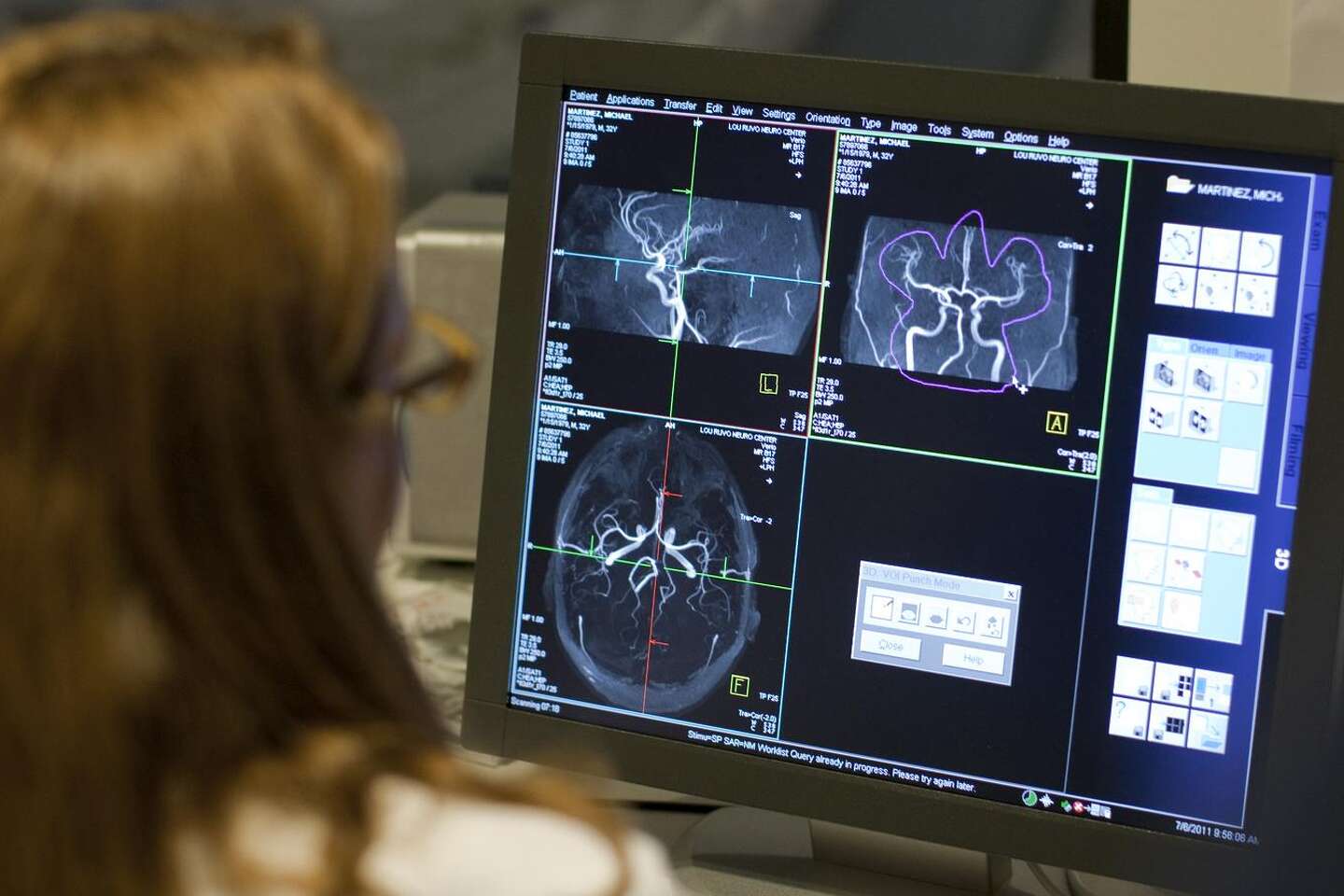 First blood test to detect concussions approved