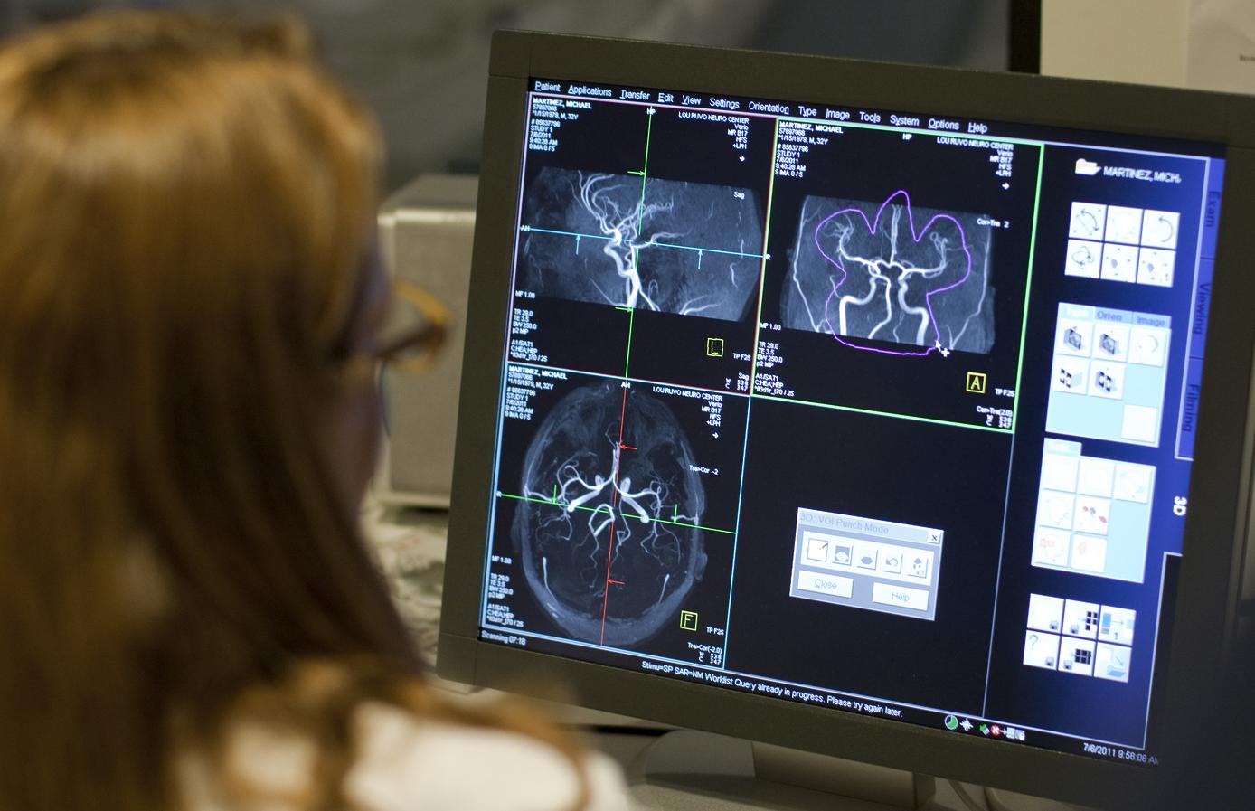 First blood test to detect concussions approved