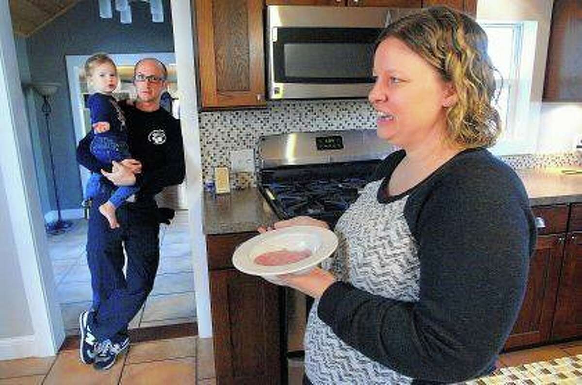 Woman lives life without a stomach