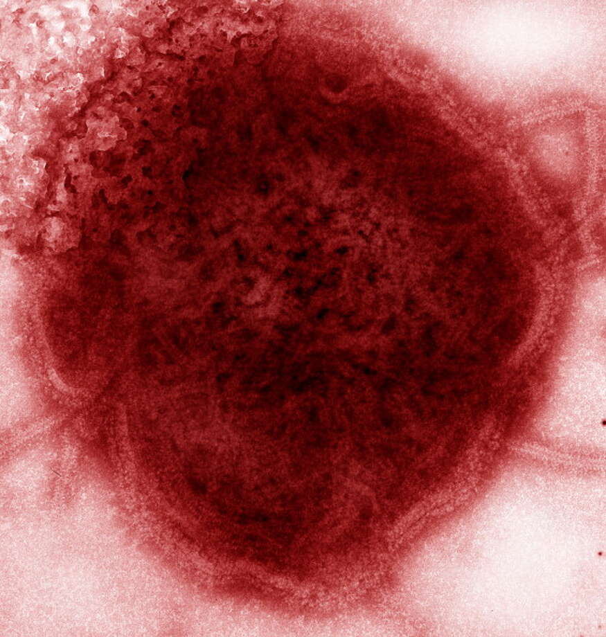 Mumps outbreak confirmed at ICE detention facility in Houston - Houston ...