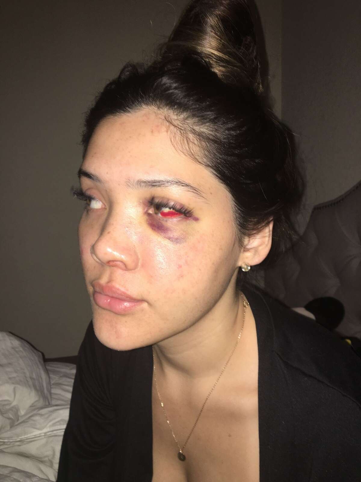 Woman accuses fiance, a police officer, of assault