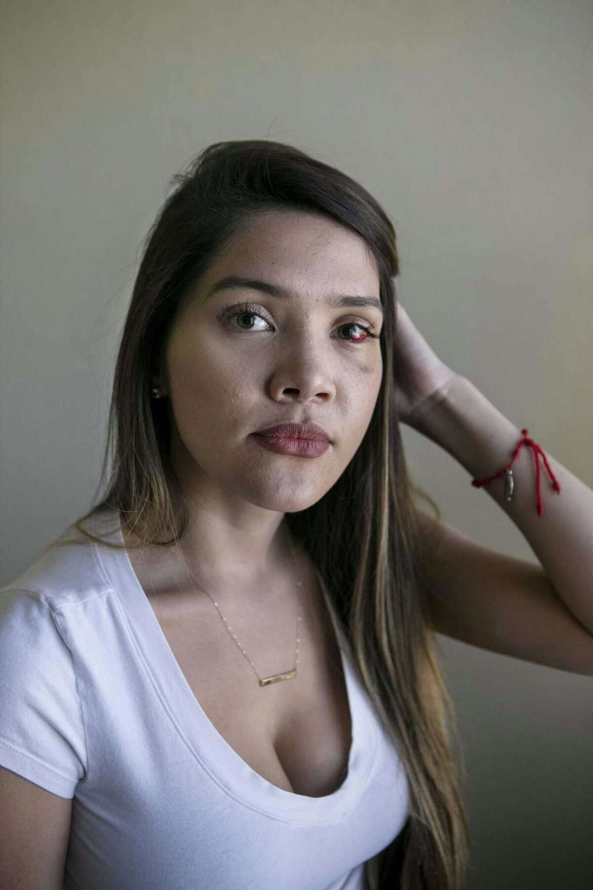 Woman accuses fiance, a police officer, of assault