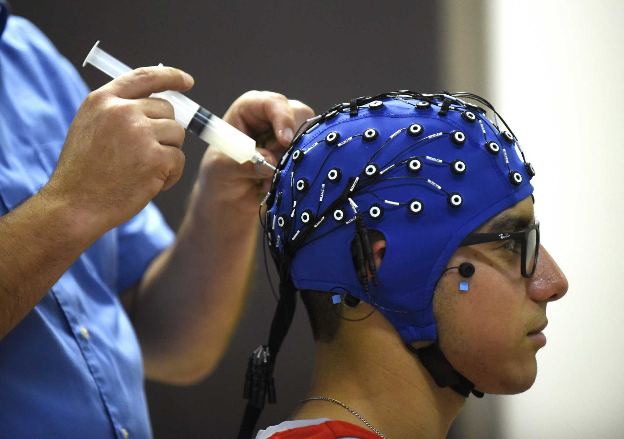With brain implants, the ‘future’s gonna be weird’