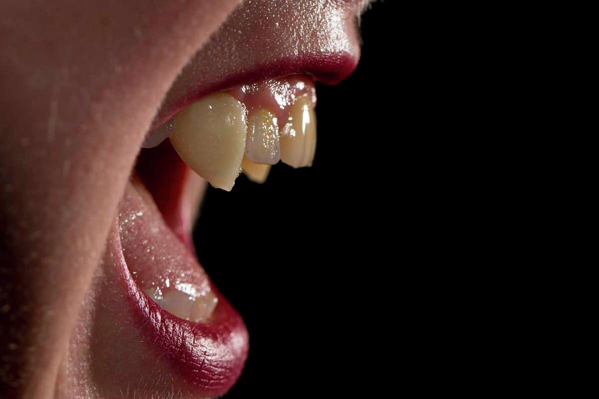 Need fangs delivered to your home? Houston’s fangsmith can do that.